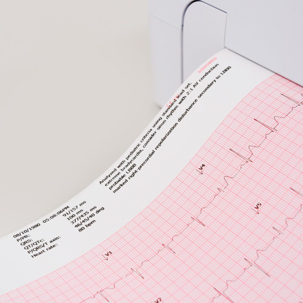 Welch Allyn CP 150 Resting ECG - EO Medical
