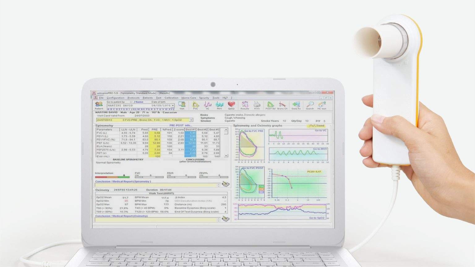 3 Tips to Get an Accurate Spirometry Test Result - for Clinics - EO Medical